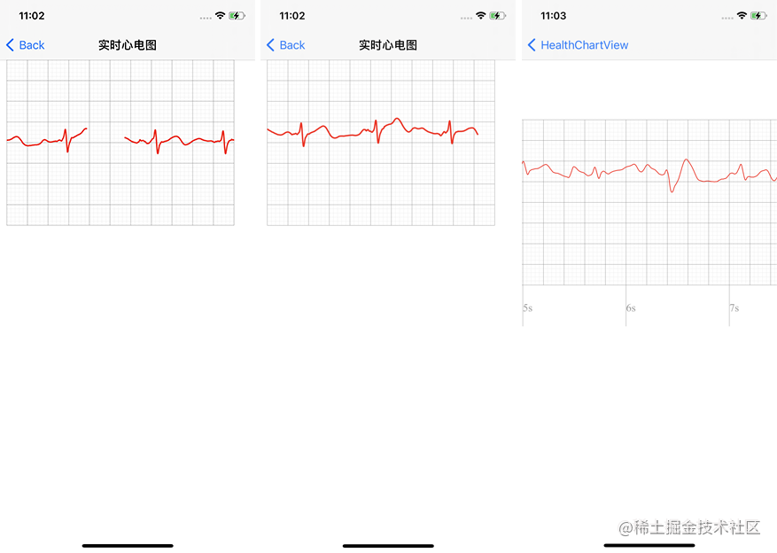 IOS ELECTROcardiogram (ECG) drawing, ECG reporting, real-time ECG ... IOS ELECTROcardiogram (ECG) drawing, ECG reporting, real-time ECG ...