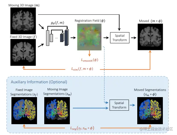 使用pytoch训练SynthMorph持续创作，加速成长！这是我参与「掘金日新计划 · 10 月更文挑战」的第11天， - 掘金